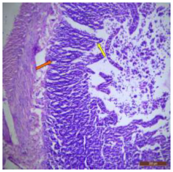 Histopathological, Scanning and Transmission Electron Microscopic Study ...