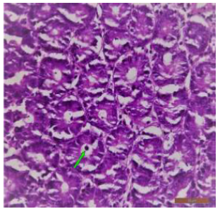 Histopathological, Scanning and Transmission Electron Microscopic Study ...